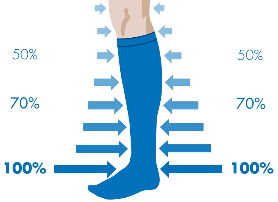 Vse Kar Morate Vedeti o Kompresijskih Nogavicah
